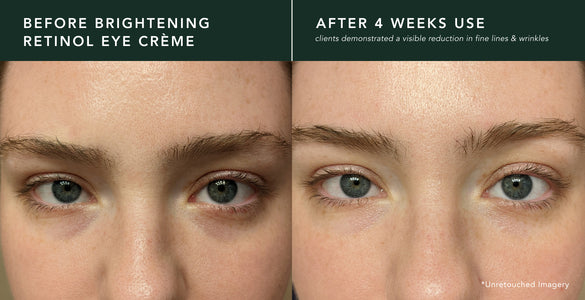 Brightening Retinol Eye Creme | RANAVAT Brightening Retinol Eye Creme | RANAVAT